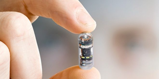 Capsule Endoscopy - ADONIS International